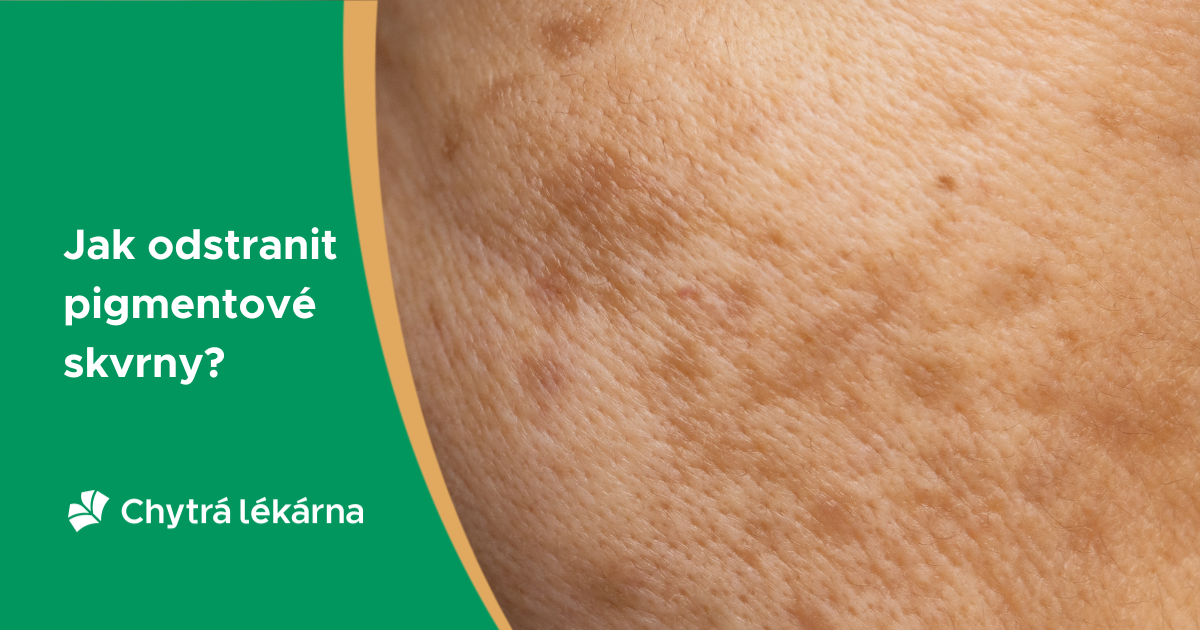 Pigmentové skvrny: jak je odstranit a co poslouží jako nejlepší ...
